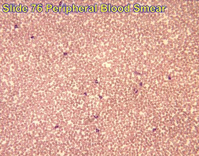 Peripheral Blood