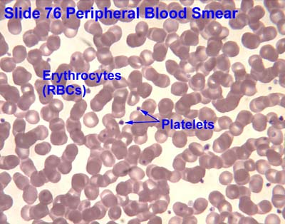 Platelets Histology