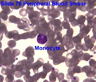Peripheral Blood