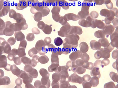 Peripheral Blood