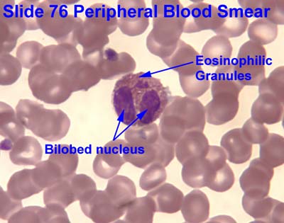 Peripheral Blood