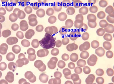 Peripheral Blood