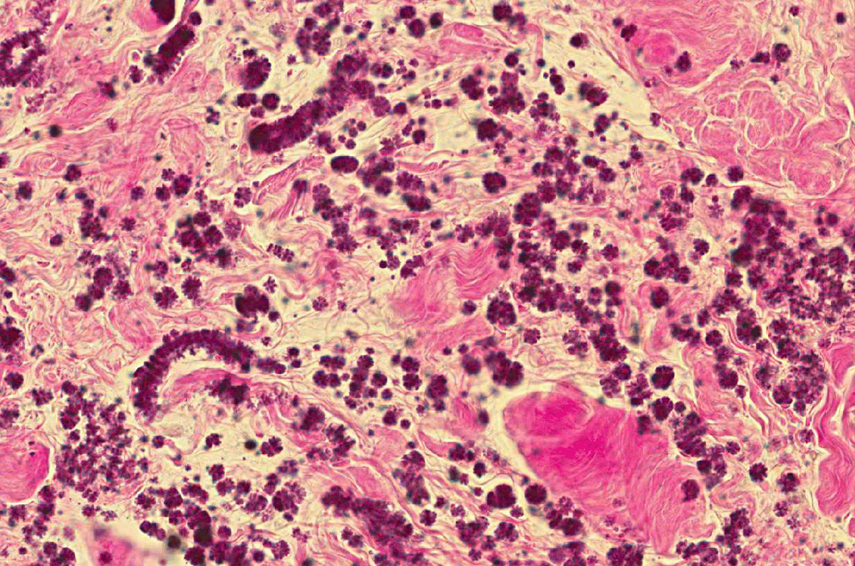 Elastic Stain Elastic Stain: On elastic stain, these clusters of beads ...